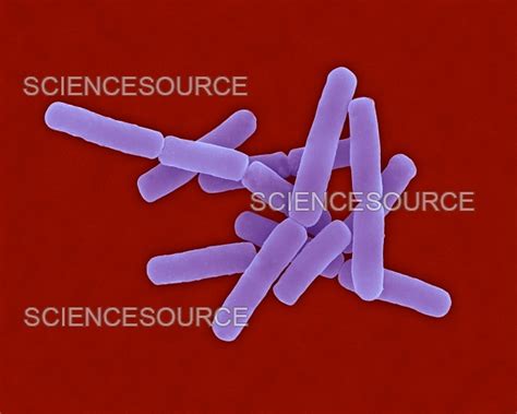 Bacillus Anthracis Bacterium Sem Stock Image Science Source Images
