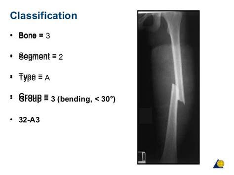 Ao Classification