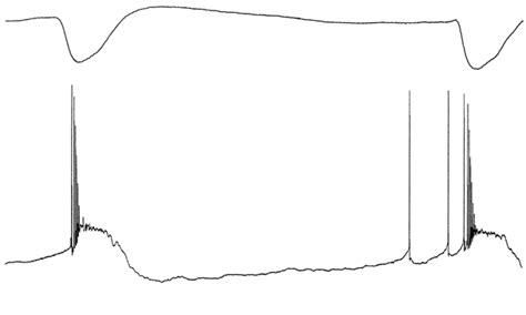 Tentative Representation Of Different Synaptic And Intrinsic Currents