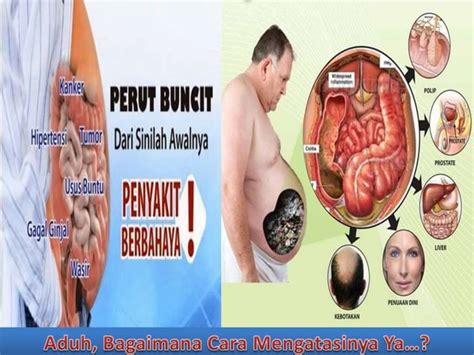 Bahaya Perut Buncit Bagi Kesehatan Ppt