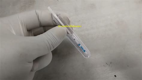 Cholera Introduction Causative Agent Pathogenicity Symptoms