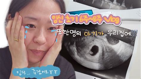 둘째 임신 임밍아웃 브이로그 임신 초기 6주~8주 입덧 시작 입덧약 처방 Youtube