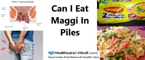 Can We Eat Maggi In Piles Why Maggi Should Not Be Eaten In Piles