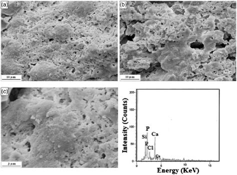 Sem Images And Edx Analysis Of Cs Bg Ha Nanocomposite At Ab Low And