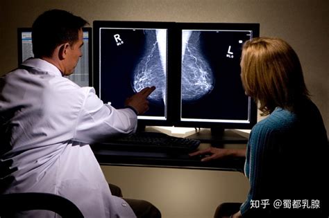 乳腺钼靶怎么做它有哪些优缺点 知乎
