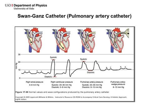 Pa Cath Waveforms Heart Catheterization Physics Department Respiratory Therapy