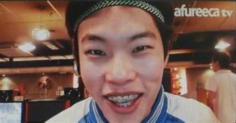 어남류 류준열 아프리카 Bj 변신 철제 교정기 헤어밴드 폭소만발