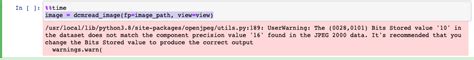 Error With Running Read Dicom Image Following Your Guide In Github · Issue 1 · Mazurowski