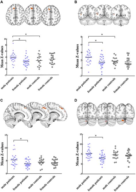 Intrinsic Functional Connectivity Differences Between Male And Female Download Scientific
