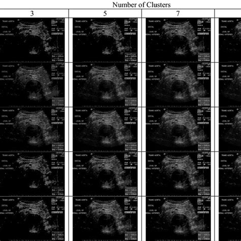 A Visual Comparative Study Of The Different Segmentation Approaches