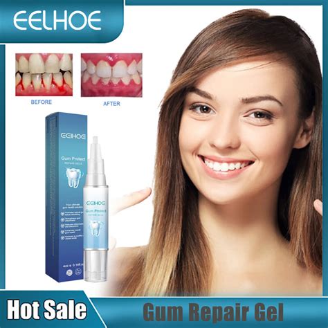 잇몸 복구 젤 미백 강화 치아 얼룩 제거 잇몸 염증 감소 구취 보호 구강 젤 구강 위생