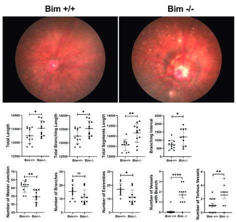 Increased Retinal Branching In The Absence Of Bim Fundus Imaging Was Download Scientific