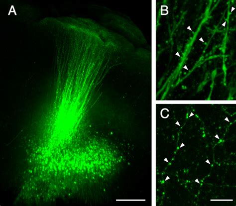 A Tissue Clearing Method For Neuronal Imaging From Mesoscopic To Microscopic Scales Protocol