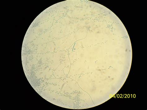 Microbiology Techniques Sapprophyte