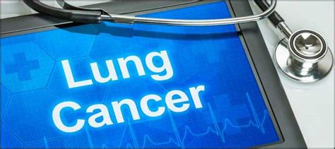 Lung Cancer Mobile App Could Extend Life Expectancy Ary News