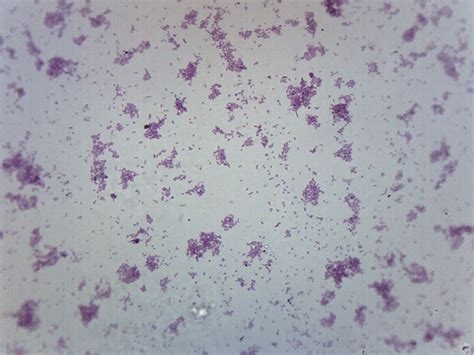 Proteus Gram Stain