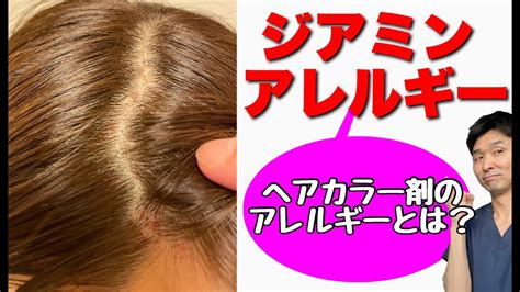 【ジアミンアレルギー 】白髪染め・ヘアカラー剤のアレルギー〜ジアミン不使用・ノンジアミン・ヘナ・ヘアマニキュア予防と対策〜【千葉市の腰痛専門
