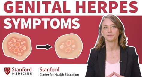 Genital Herpes Symptoms And Causes