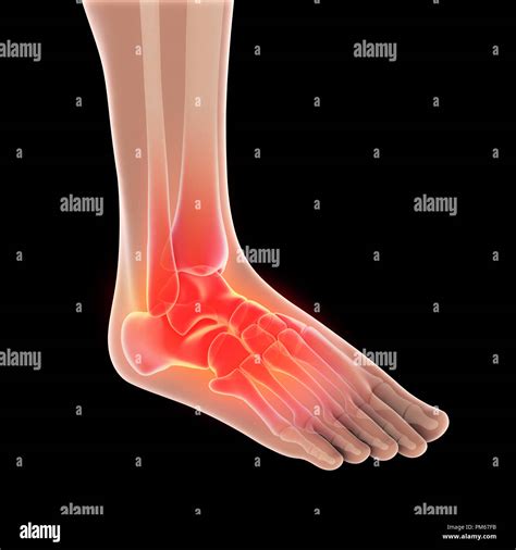 Peroneus Brevis Stockfotos Und Bilder Kaufen Alamy