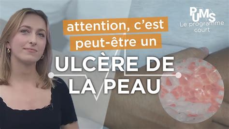 Reconnaître Un Ulcère De La Peau Ulcère Cutané Attention Aux Lésions