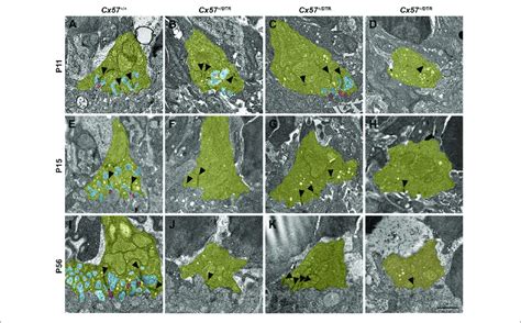 Loss Of On Bipolar Cell Invaginations In Cone Terminals A L