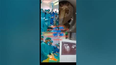 ভারতে এক মহিলার পেটে সাপের চলে জন্ম।ভিডিও দেক্তা ক্লিক করুন।viralvideo