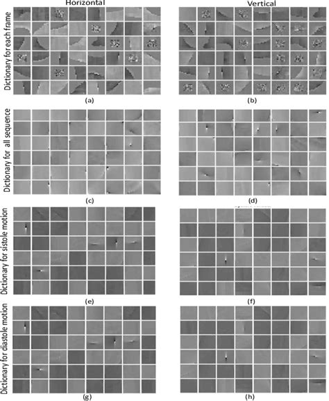 Figure 2 From Cardiac Motion Estimation Using Convolutional Sparse Coding Semantic Scholar