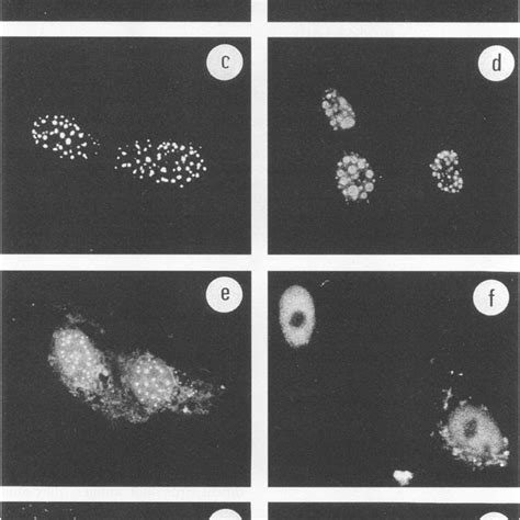 Intracellular Distribution Of Various Deleted And Truncated Forms Of