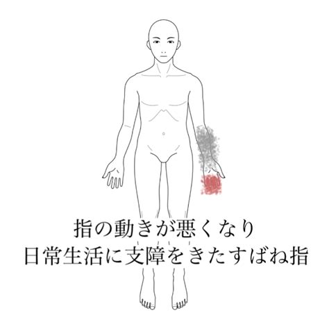 指の動きが悪くなり日常生活に支障をきたす中指痛｜手・手指の痛み、バネ指のツボ｜ツボネット 鍼灸の症例が検索できるツボ辞典