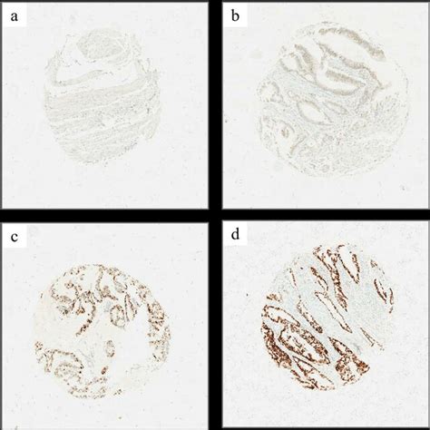 Original Ihc Images Corresponding To Different Scores A Negative Download Scientific