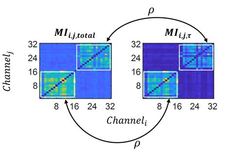Mutual Information Reveals Temporal Dynamics Of Functional Connectivity In Awake Auditory Cortex