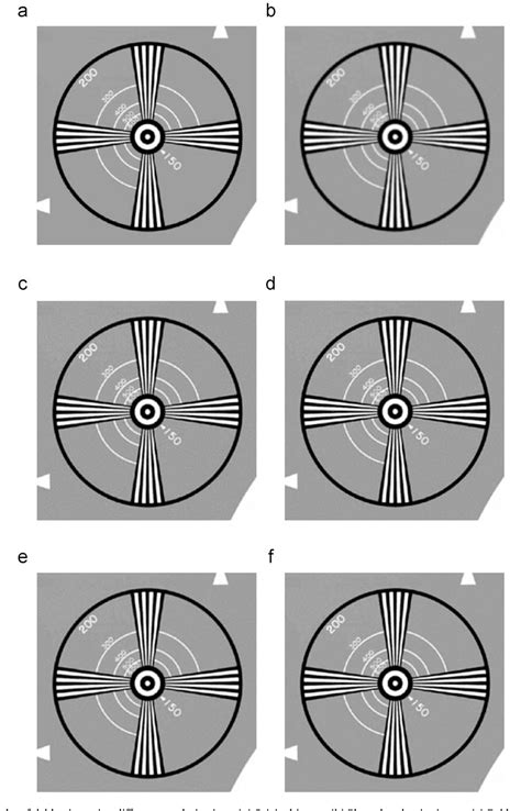 Figure 2 From A Super Resolution Reconstruction Algorithm For Surveillance Images Semantic Scholar
