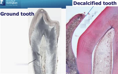Diagram Of Tooth X Ray Quizlet