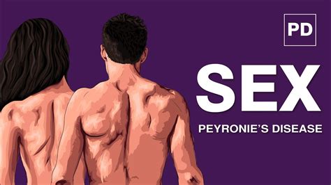 Peyronies Disease And Sex The Impact Of PD On Your Sex Life PD And Shockwave Therapy