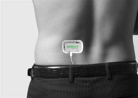 Peripheral Nerve Stimulation Vs Traditional Treatments A Comparative