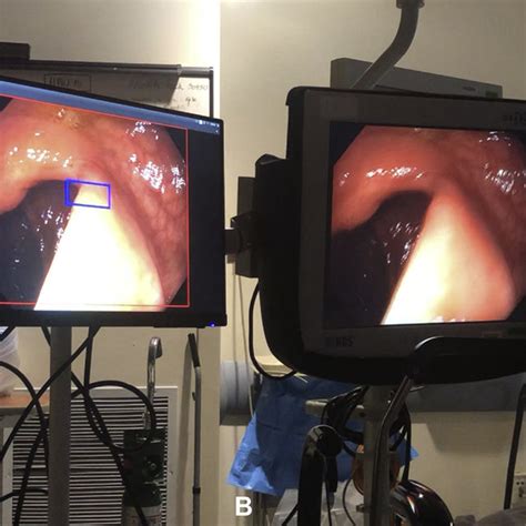 Example Output Of The Computer Aided Detection System The Indicator