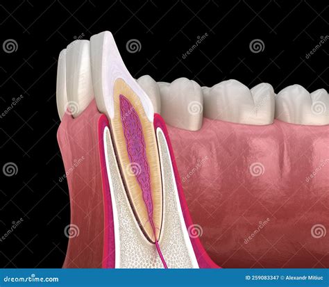 Anatomy Of Maxillary Lateral Incisor Tooth And Gum Cross Section Medically Accurate Dental 3d