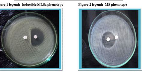 Figure 1 From Inducible Clindamycin Resistance Among Staphylococcus Aureus Isolates Semantic