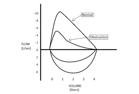 Top 5 Spirometry Tips For Copd Diagnosis And Management Respiratory