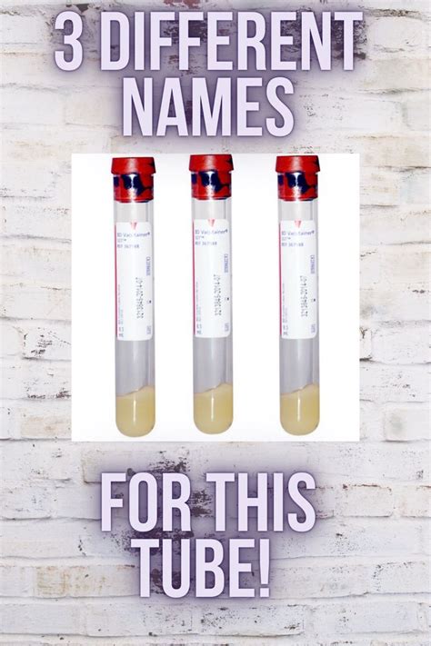 What Color Is Sst Tube Phlebotomy At Blake Sexton Blog