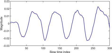 Figure 1 From An Overview Of Signal Processing Techniques For Remote Health Monitoring Using