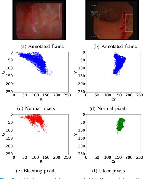 Figure 3 From Detection Of Ulcerative Colitis Lesions From Weakly