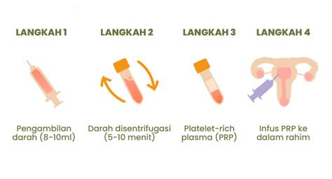 Terapi PRP Betulkah Efektif Untuk Memperbaiki Endometrium