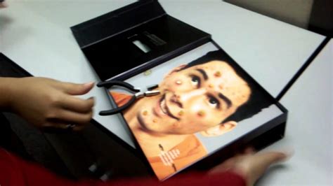 Exploding Pimple YouTube