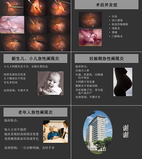 阑尾炎ppt模板 卡卡办公