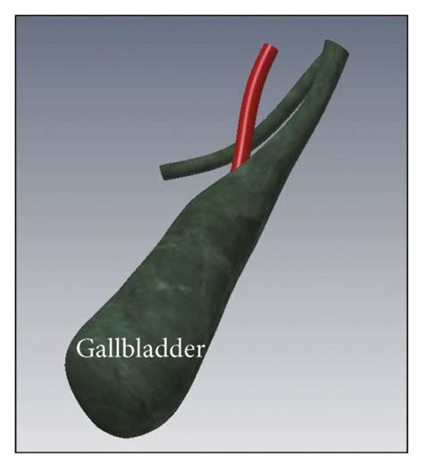 Difference Between A Pediatric Laparoscopic Cholecystectomy Protocol