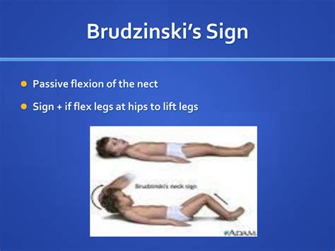 Ppt Seizures And Cns Infections Powerpoint Presentation Free