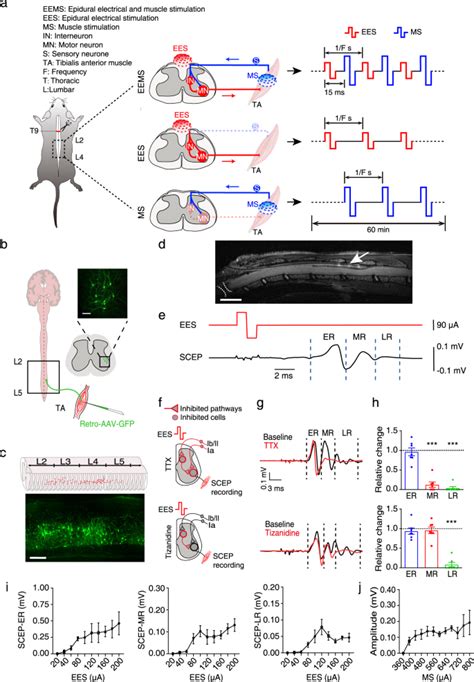 脊髓 肌肉界面的双重电刺激可重建脊髓损伤后的脊髓感觉运动回路 Nature Communications X Mol