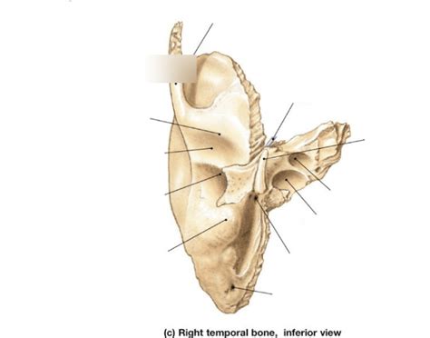 Temporal Inferior Diagram Diagram Quizlet