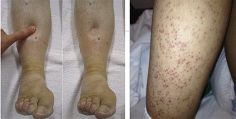 Chapter Pictures Flashcards Quizlet Chapter Pictures Flashcards Quizlet